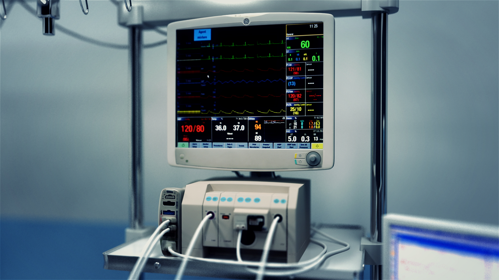 Virtual ICU - ESICM